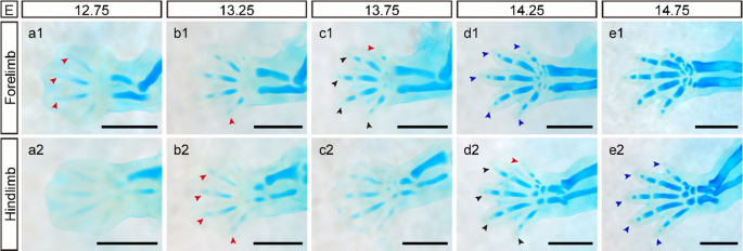 Proximal phalanges of digit 1 have different identities in the ...