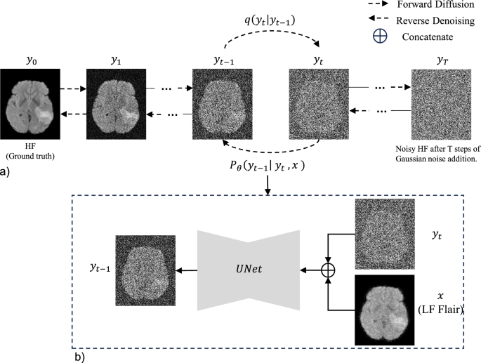 In-silico comparison of a diffusion model with conventionally trained ...