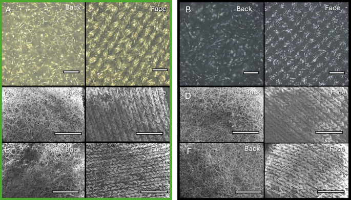 Reducing microplastic fiber shedding from hand-washed polyester ...