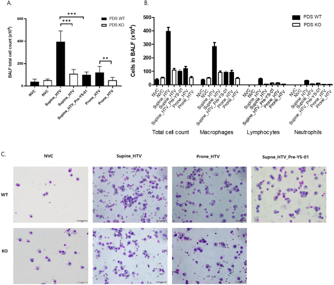Pendrin inhibition is associated with protective effect of prone ...