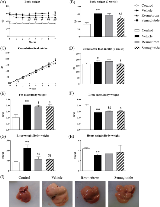 Differences between therapeutic mechanisms of resmetirom and ...