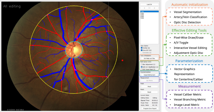 Improving retinal vessel assessment precision by integrating deep ...