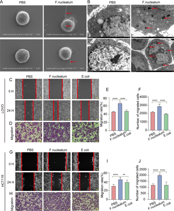 Single-cell and bulk transcriptomics reveal Fusobacterium nucleatum ...