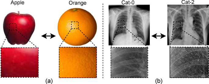 Multiscale attention generative adversarial networks for lesion ...