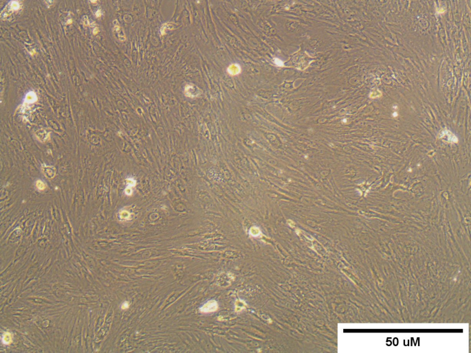 The efficacy of bone marrow-derived mesenchymal stem cells in restoring ...