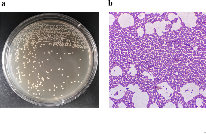 Evaluation of probiotic properties of Bacillus aryabhattai HY1 isolated ...