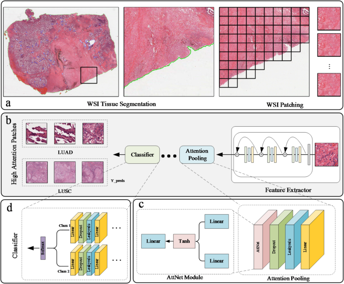 Non-small cell lung cancer subtype classification based on cross-scale ...