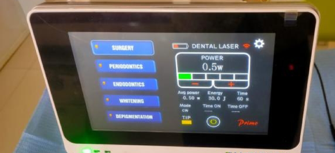 Laser-assisted socket seal surgery using bioactive glass for dental ...