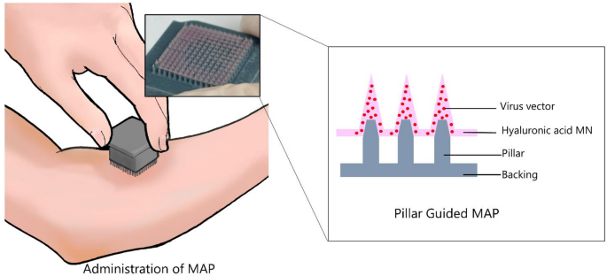Precision dosing of recombinant vaccinia vaccine via pillar-guided ...