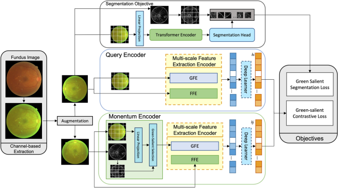 Multi scale self supervised learning for deep knowledge transfer in diabetic retinopathy grading ...
