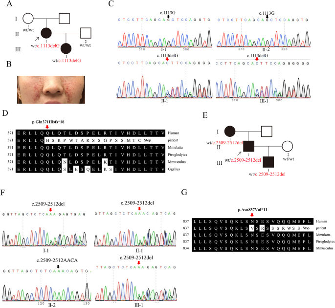 TSC complex decrease the expression of mTOR by regulated miR-199b-3p ...