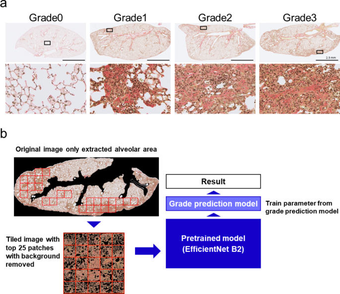 Optimized digital workflow for pathologist-grade evaluation in ...