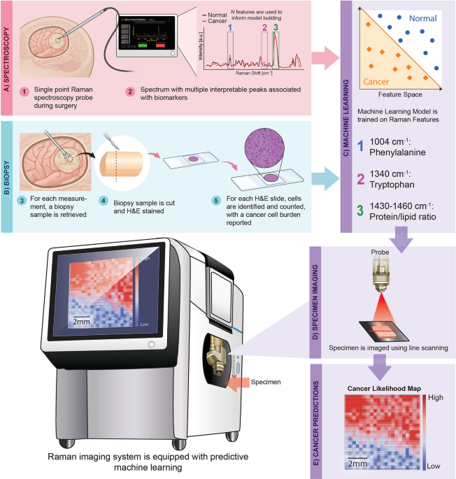 Preliminary study demonstrating cancer cells detection at the margins ...