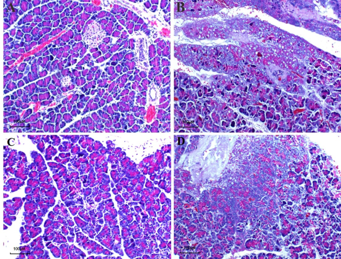 Mechanism of calcitonin gene related peptide against acute pancreatitis ...
