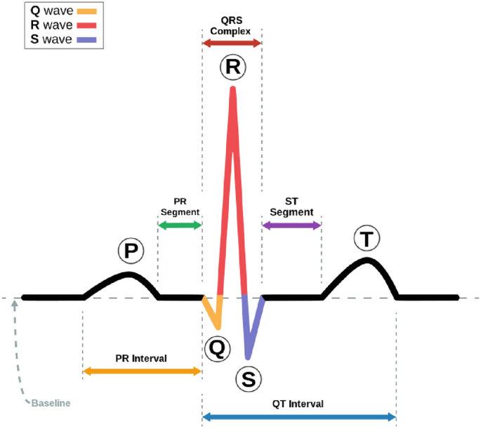 ECG heartbeat classification using progressive moving average transform ...