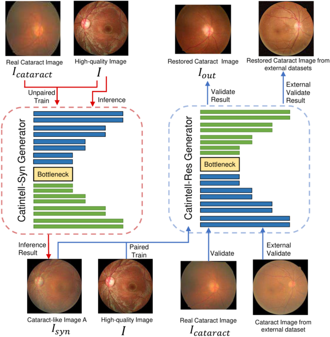 Versatile cataract fundus image restoration model utilizing unpaired ...