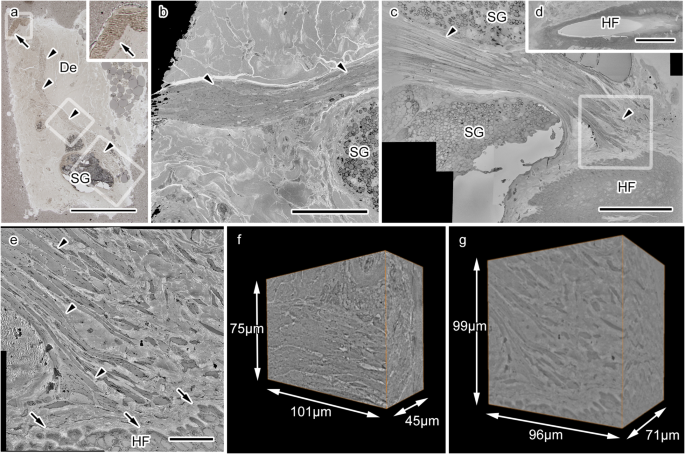 Three-dimensional ultrastructural analysis of human skin with the ...