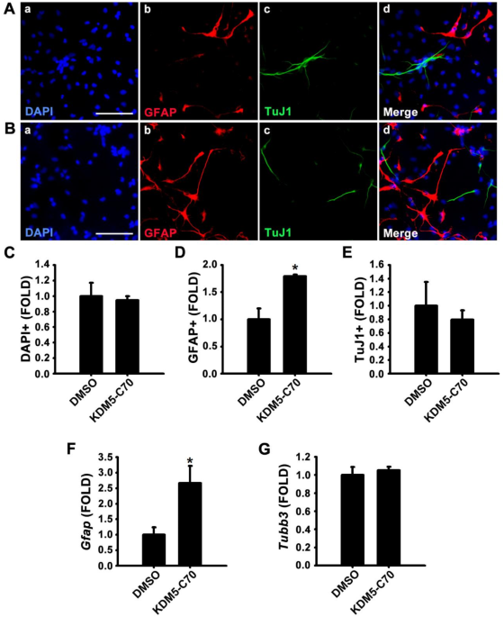 Histone demethylase inhibitor KDM5-C70 regulates metabolomic and ...