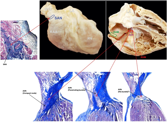 Proteomic profile of human sinoatrial and atrioventricular nodes in ...