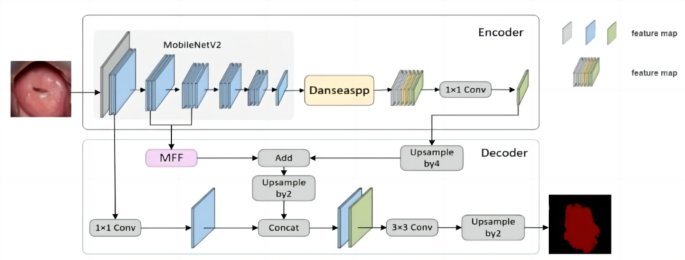 A novel lightweight multi-scale feature fusion segmentation algorithm for real-time cervical ...