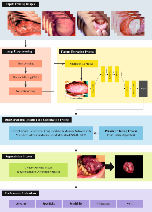 Deep structured learning with vision intelligence for oral carcinoma ...