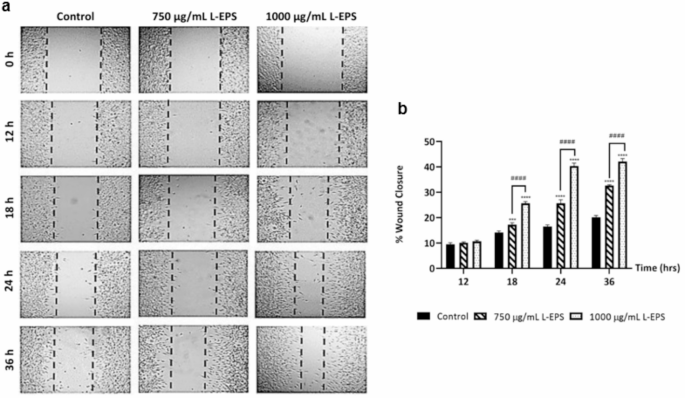 Investigation of multifaceted wound healing effect of exopolysaccharide ...