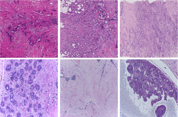 Deeply supervised two stage generative adversarial network for stain ...