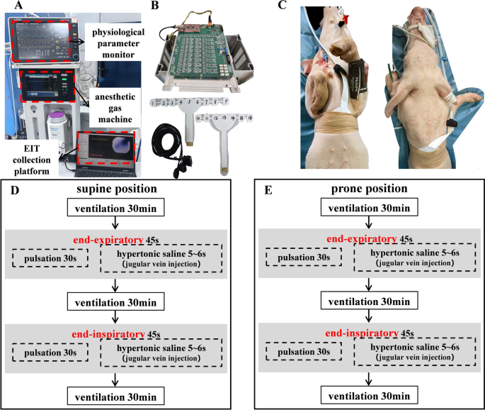 Feasibility of the dynamic EIT technique for non-invasive monitoring of ...