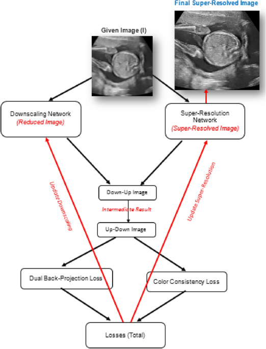 Enhancing fetal ultrasound image quality and anatomical plane recognition in low-resource ...