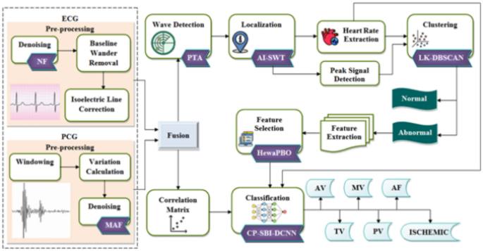 Integrated fusion approach for multi-class heart disease classification through ECG and PCG ...