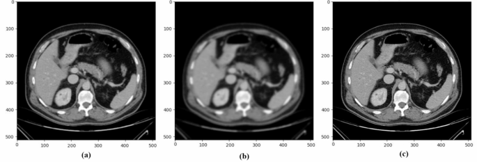 Liver margin segmentation in abdominal CT images using U-Net and Detectron2: annotated dataset ...