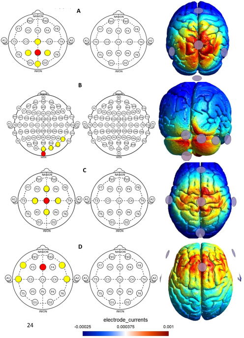 Effects of transcranial electrical stimulation of the cerebellum, parietal cortex, anterior ...
