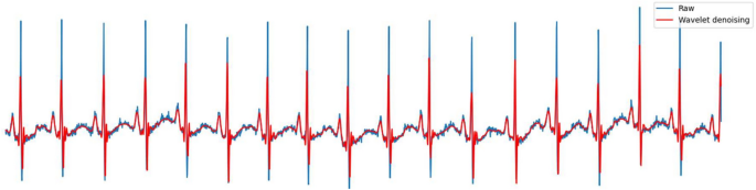 Classification of multi-lead ECG based on multiple scales and ...