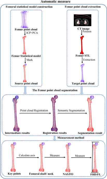 Automatic measurement of proximal femoral morphological parameters using point cloud semantic ...