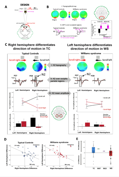 Brain lateralization for perceiving direction of motion is reversed in ...
