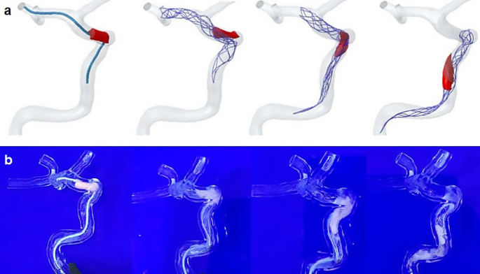 A comparative study on the efficacy of two different types of ...
