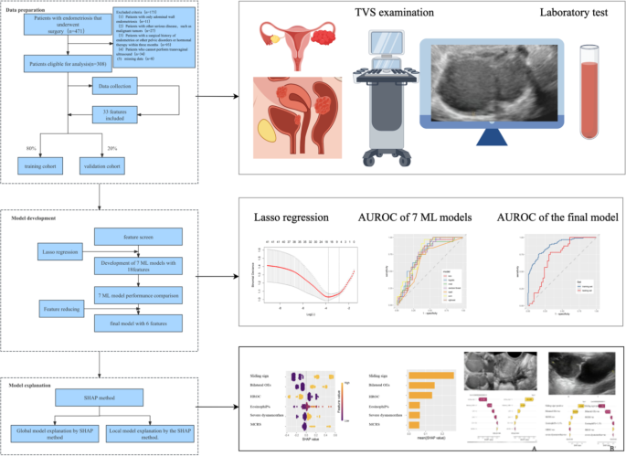 Identification and validation of a novel machine learning model for predicting severe pelvic ...