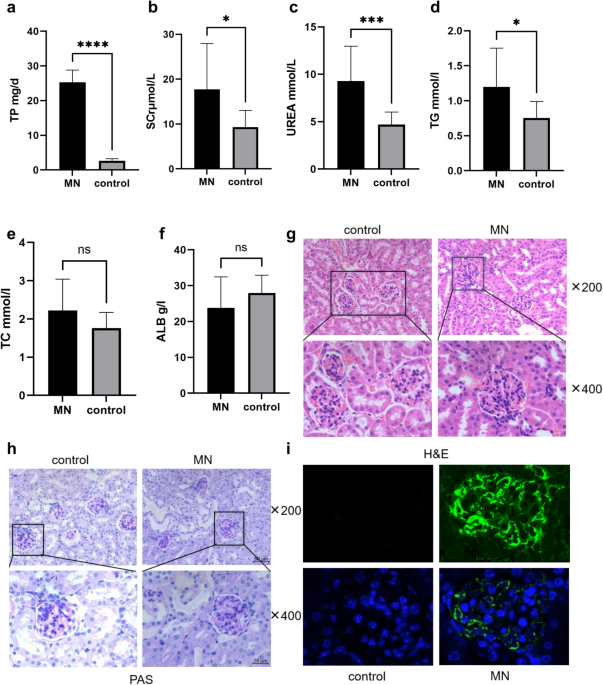Rapid diagnosis of membranous nephropathy based on kidney tissue Raman ...