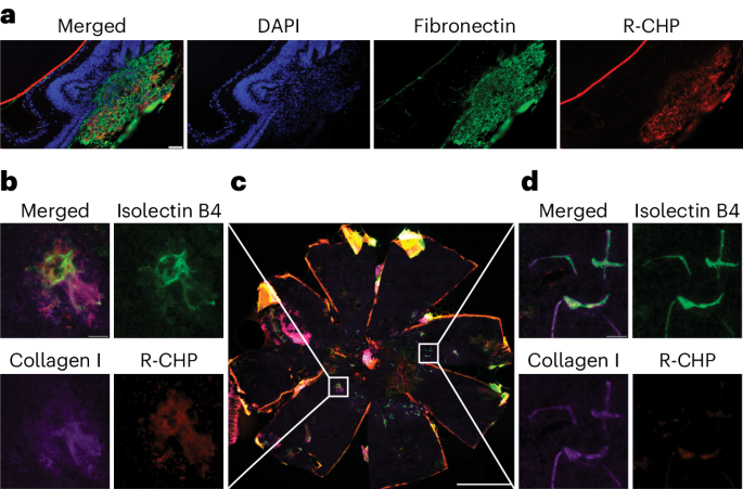 In vivo monitoring of active subretinal fibrosis in mice using collagen ...
