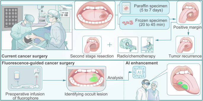 Illuminating the future of precision cancer surgery with fluorescence ...
