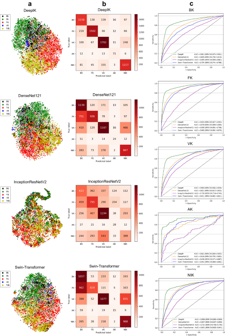 Deep learning for multi-type infectious keratitis diagnosis: A ...