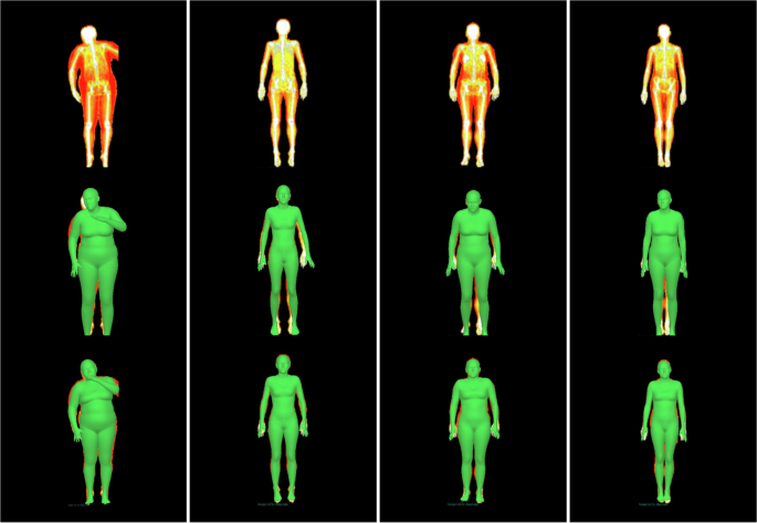 Prediction of total and regional body composition from 3D body shape ...