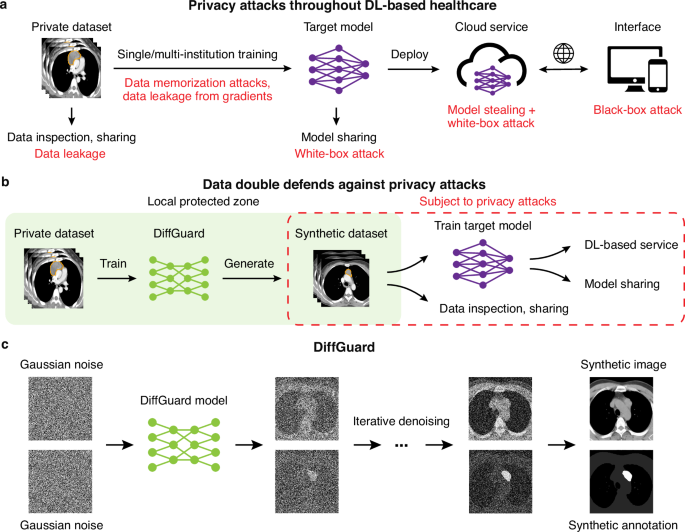 Privacy enhancing and generalizable deep learning with synthetic data for mediastinal neoplasm ...