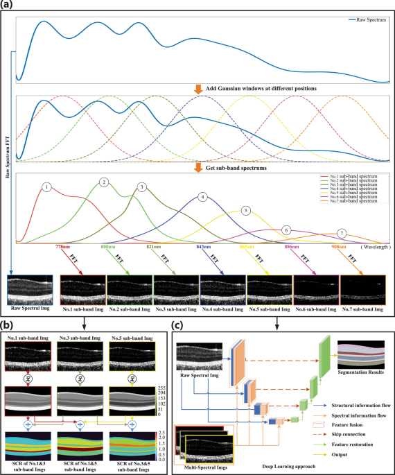 Fusing multispectral information for retinal layer segmentation | npj ...
