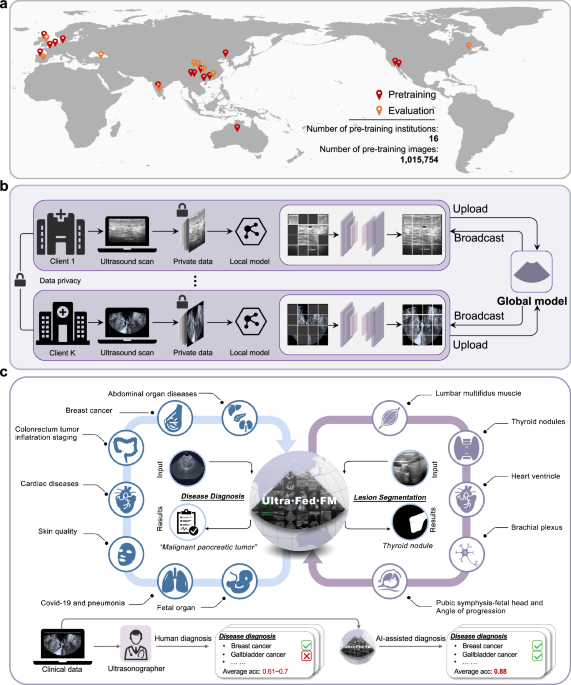 From pretraining to privacy: federated ultrasound foundation model with ...