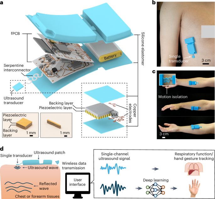 A wearable echomyography system based on a single transducer | Nature ...