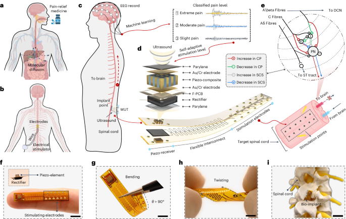 A programmable and self-adaptive ultrasonic wireless implant for ...