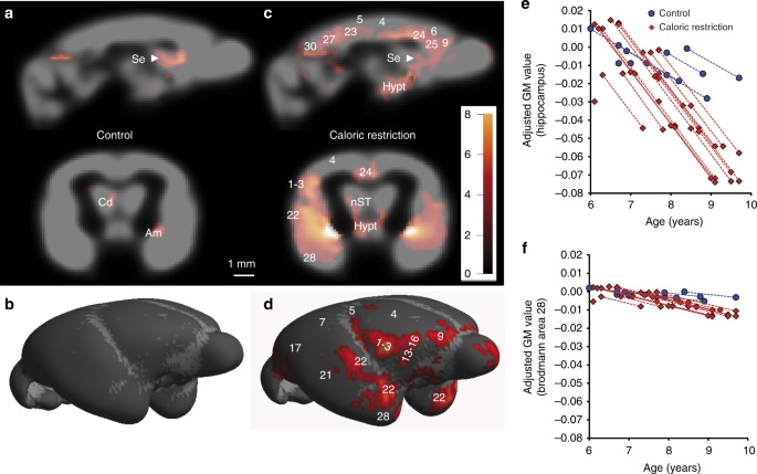 Caloric restriction increases lifespan but affects brain integrity in ...