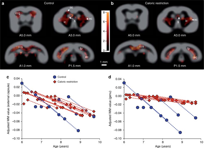 Caloric restriction increases lifespan but affects brain integrity in ...