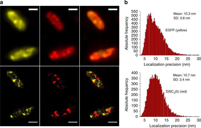Solid immersion microscopy images cells under cryogenic conditions with ...